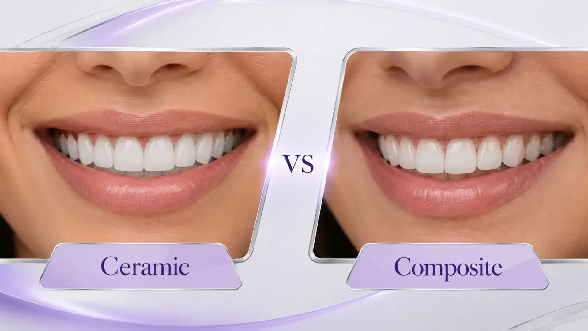 Ceramic or composite veneers: which is right for you?